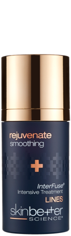 InterFuse® Intensive Treatment - Lines – Plastic Surgery Center of ...